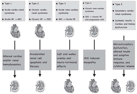 Cardiorenal syndrome | www.cimjournal.com