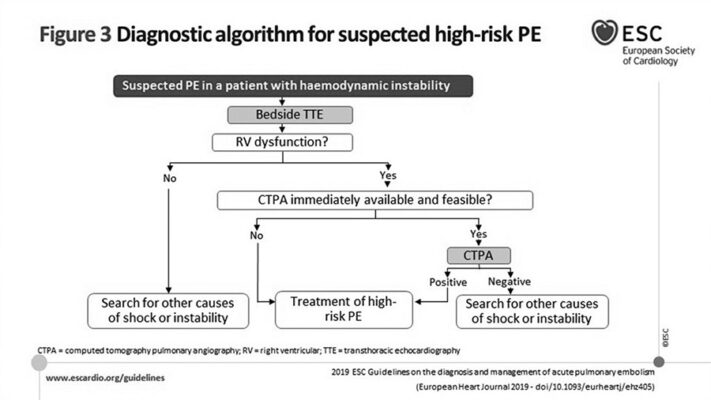 ESC Guidelines on Acute Pulmonary Embolism 2019