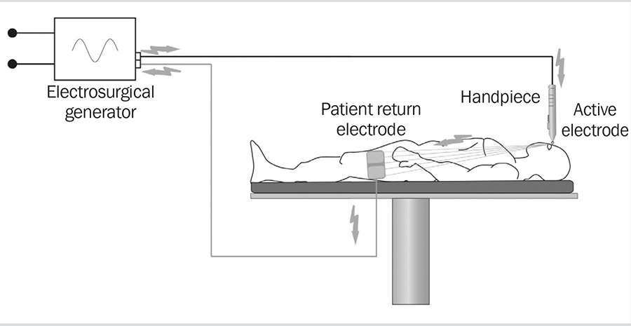 การดูแลผู้ป่วยที่ใส่ CIEDs ที่ได้รับการผ่าตัด (Perioperative management in