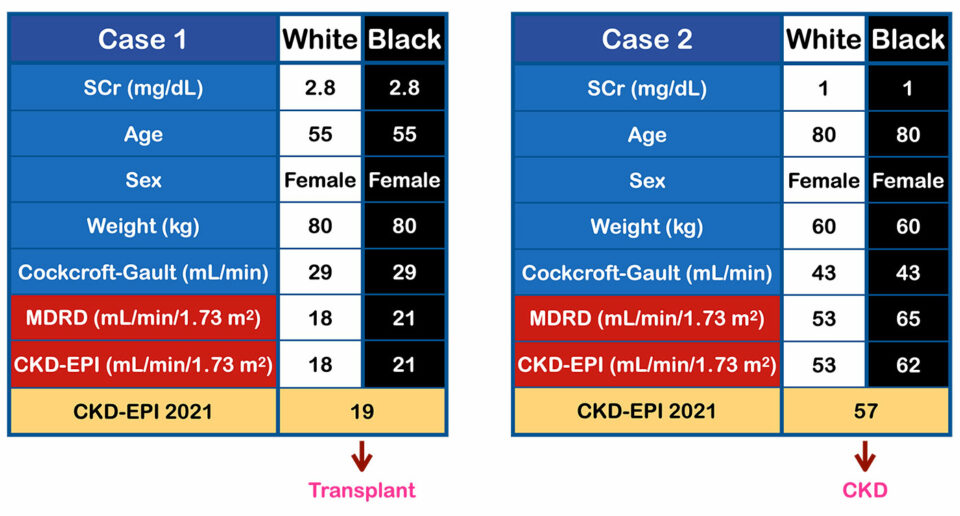 New eGFR Evaluation in CKD Population 2021: eGFR Formula