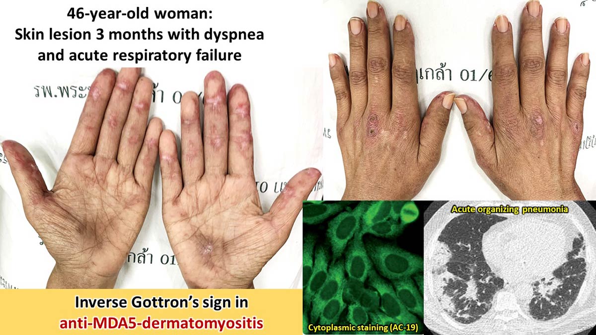 Spot Diagnosis in Rheumatology