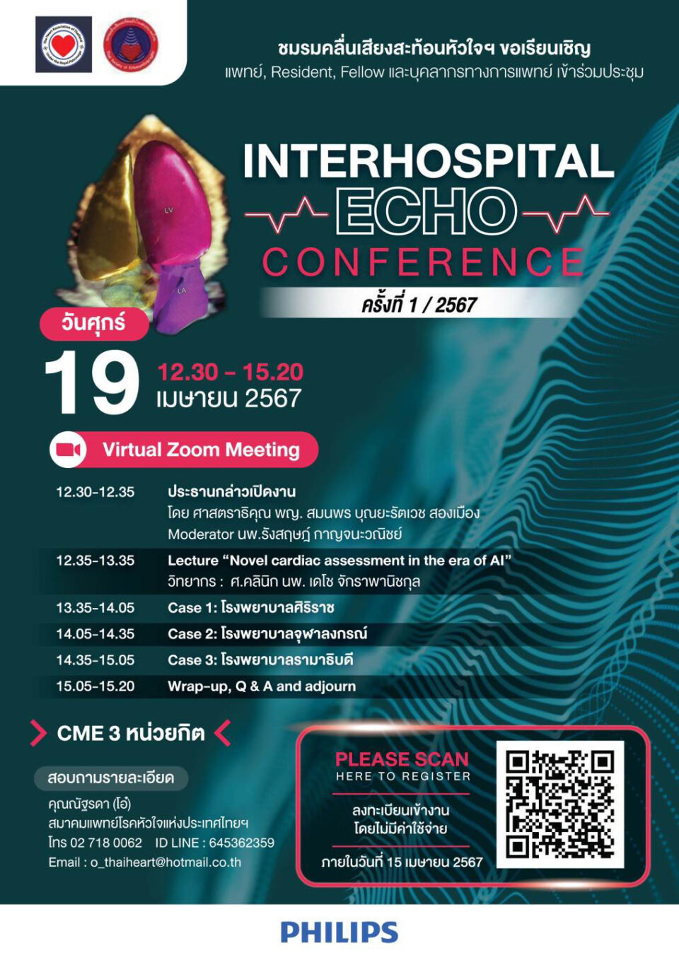 Interhospital echo conference ครั้งที่ 1/2567