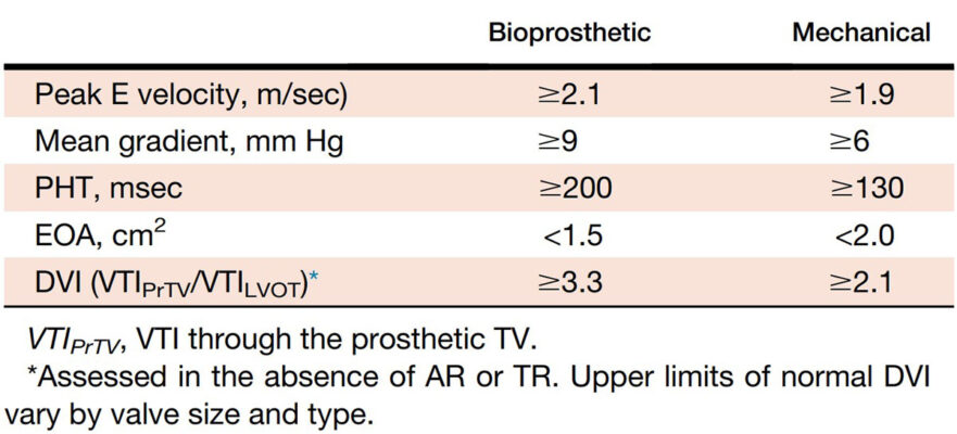 Echocardiography in Prosthetic Tricuspid valve Evaluation